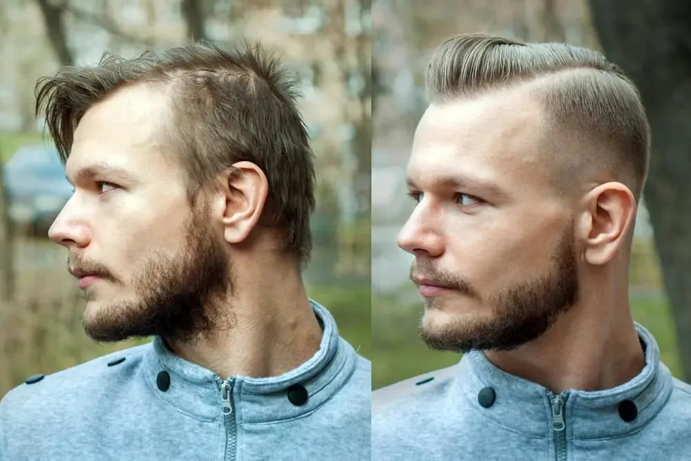 Shadow Fade Vs Skin Fade: Differences And How To Choose