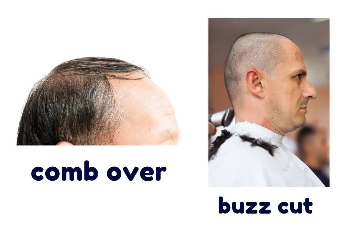 The Comb Over Vs Other Balding Styles [Photo Comparisons]
