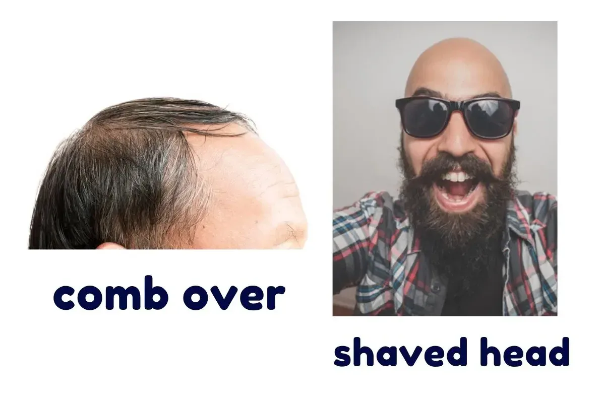 The Comb Over Vs Other Balding Styles [Photo Comparisons]